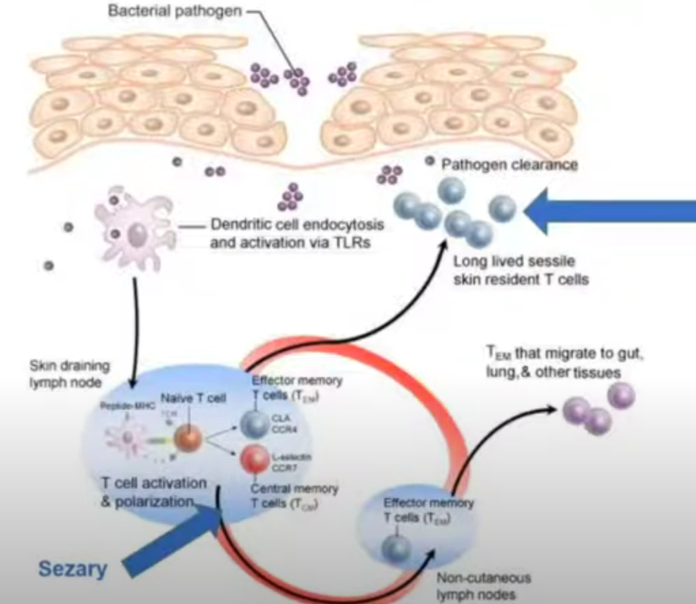PATIENT RESOURCES – Sézary Syndrome Society