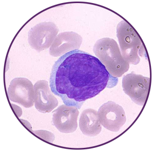 Sézary Syndrome Society – Resources for Patients with Sezary Syndrome